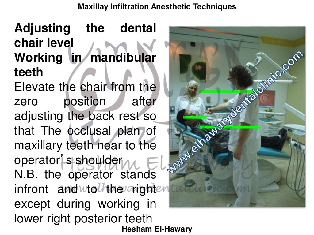 Maxillary infiltration anesthetic techniques (with photos)