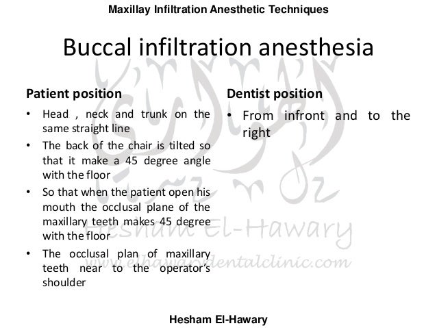 Maxillary infiltration anesthetic techniques (with photos)