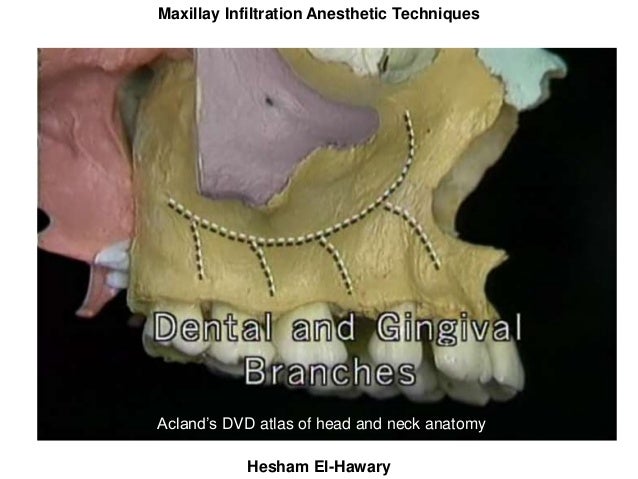 Maxillary infiltration anesthetic techniques (with photos)