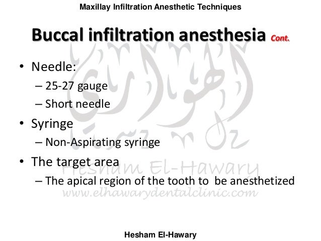Maxillary infiltration anesthetic techniques (with photos)