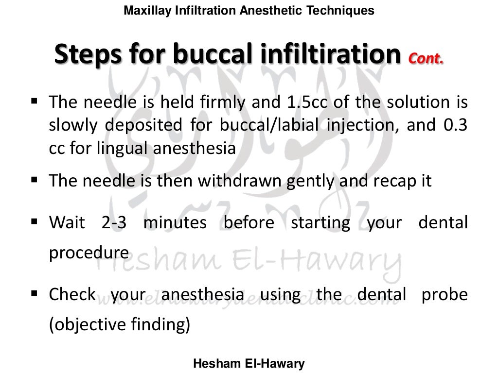 Maxillary infiltration anesthetic techniques (with photos)