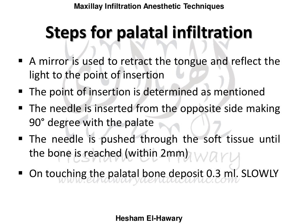 Maxillary infiltration anesthetic techniques (with photos)