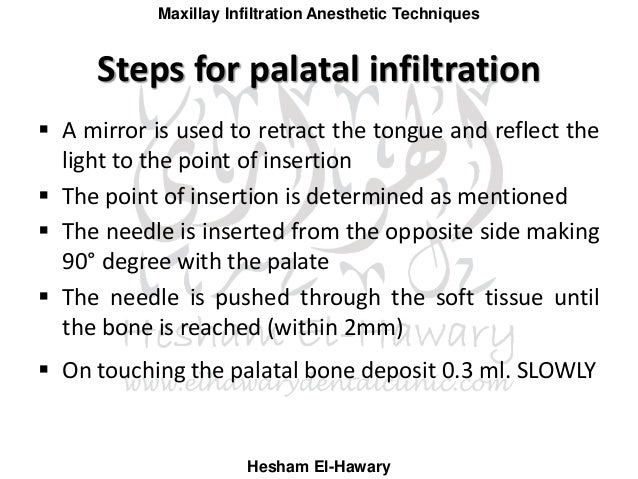 Maxillary infiltration anesthetic techniques (with photos)