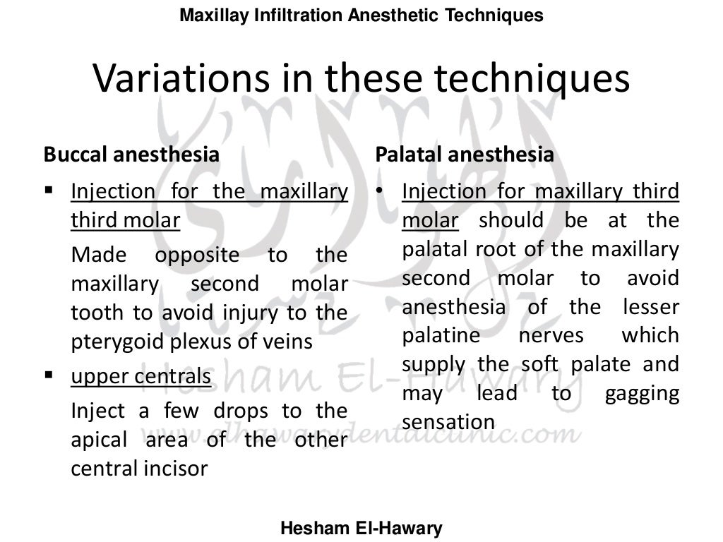 Maxillary infiltration anesthetic techniques (with photos)