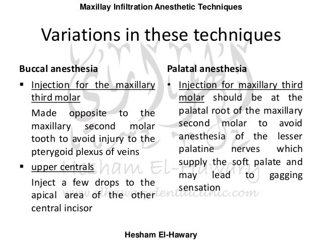 Maxillary infiltration anesthetic techniques (with photos)