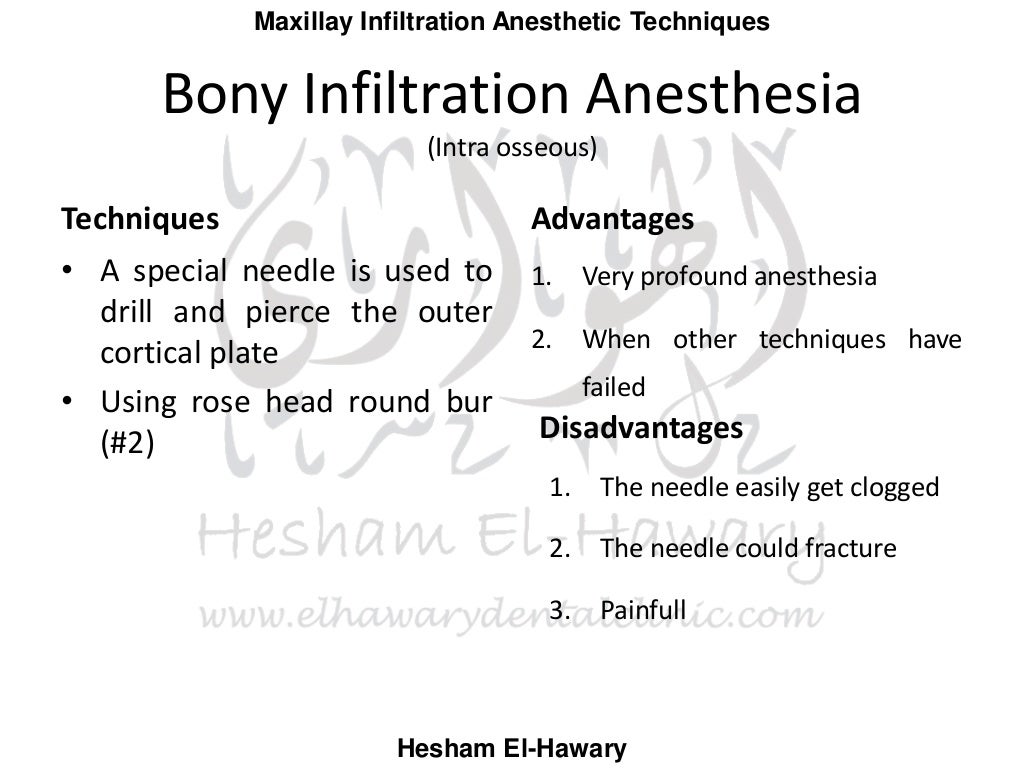 Maxillary infiltration anesthetic techniques (with photos)