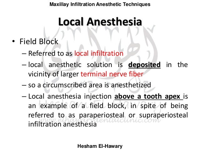 Maxillary infiltration anesthetic techniques (with photos)