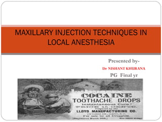 Maxillary injection techniques | PPT