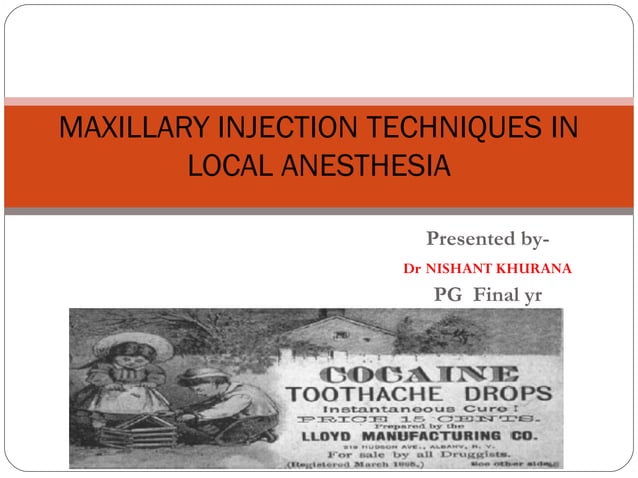Maxillary injection techniques | PPT