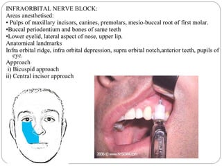Maxillary injection techniques | PPT