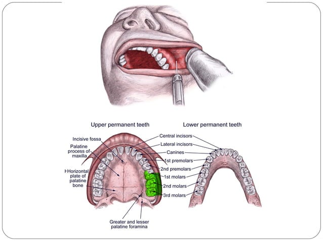 Maxillary injection techniques | PPT