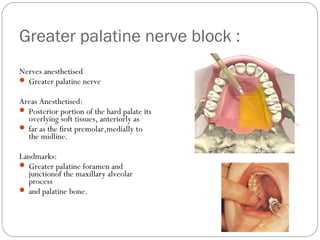 Maxillary injection techniques | PPT