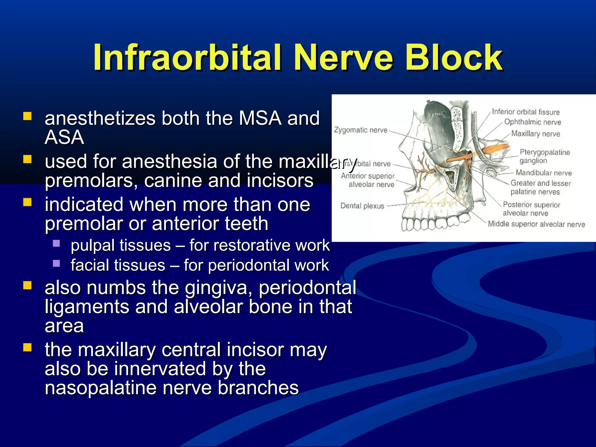 Maxillary Local Anesthesia | PPT