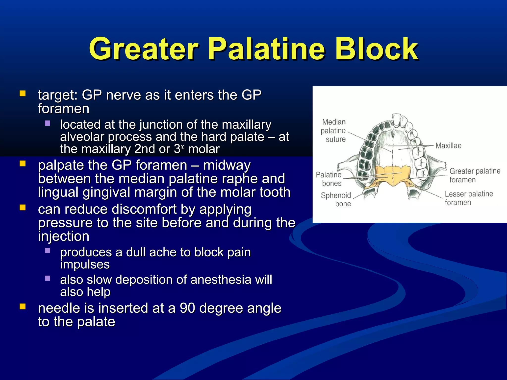 Maxillary Local Anesthesia | PPT