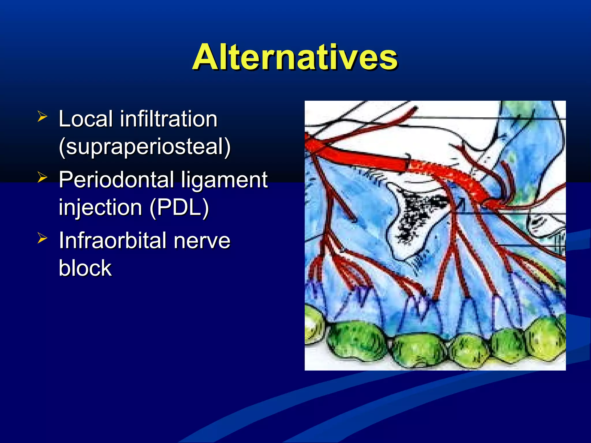 Maxillary Local Anesthesia | PPT
