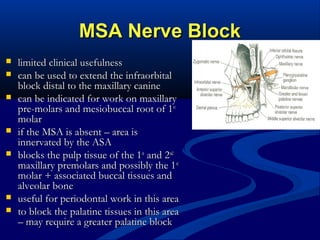 Maxillary Local Anesthesia | PPT