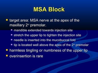 Maxillary Local Anesthesia | PPT
