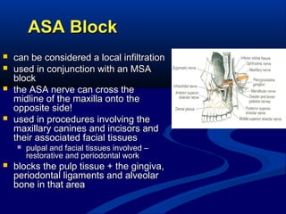 Maxillary Local Anesthesia | PPT