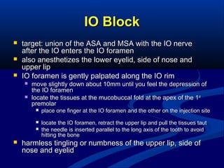 Maxillary Local Anesthesia | PPT