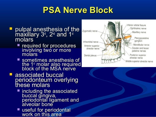 Maxillary Local Anesthesia