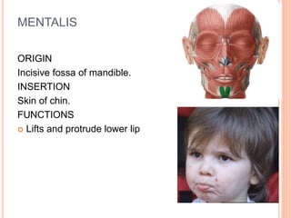 Maxillary landmarks | PPTX