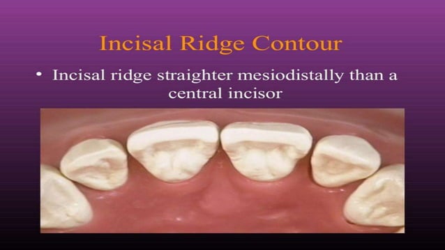 PERMANENT MAXILLARY LATERAL INCISOR | PPTX