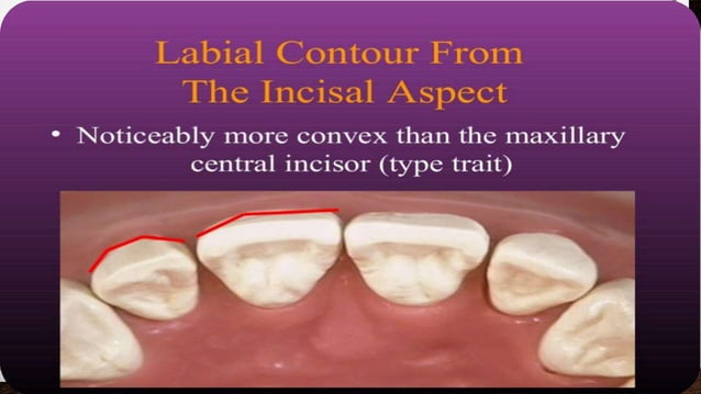 PERMANENT MAXILLARY LATERAL INCISOR | PPTX