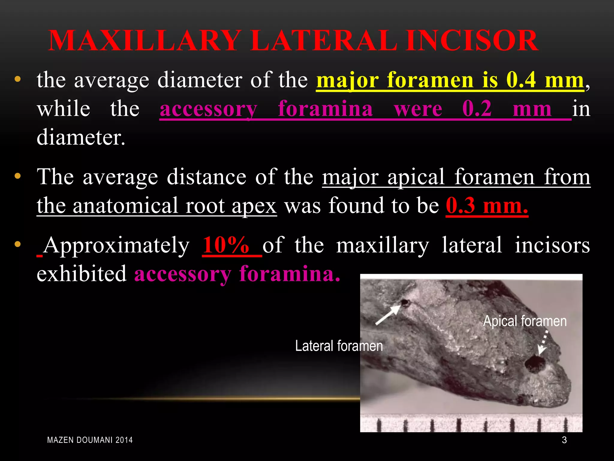 Maxillary lateral incisor | PPTX