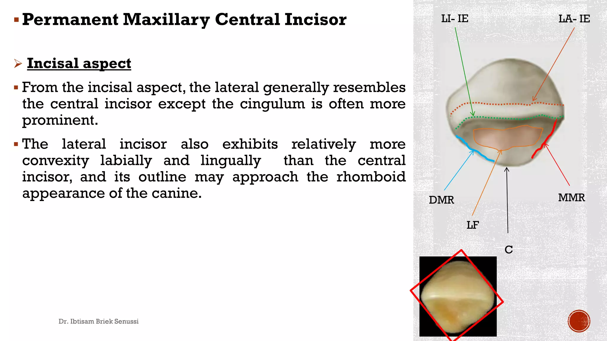 Maxillary lateral incisor. | PDF