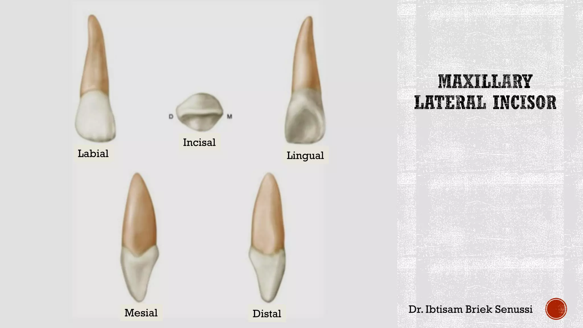 Maxillary lateral incisor. | PDF