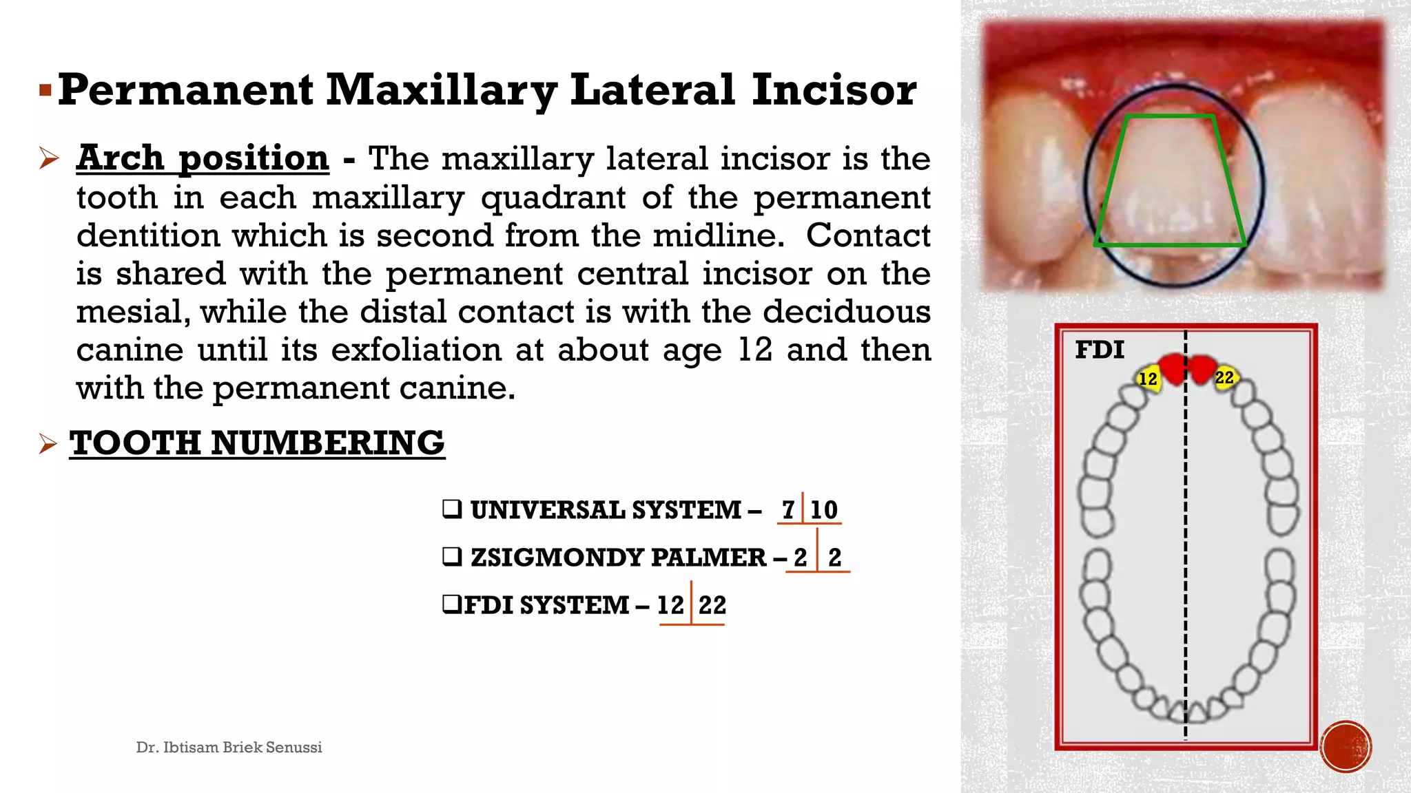 Maxillary lateral incisor. | PDF