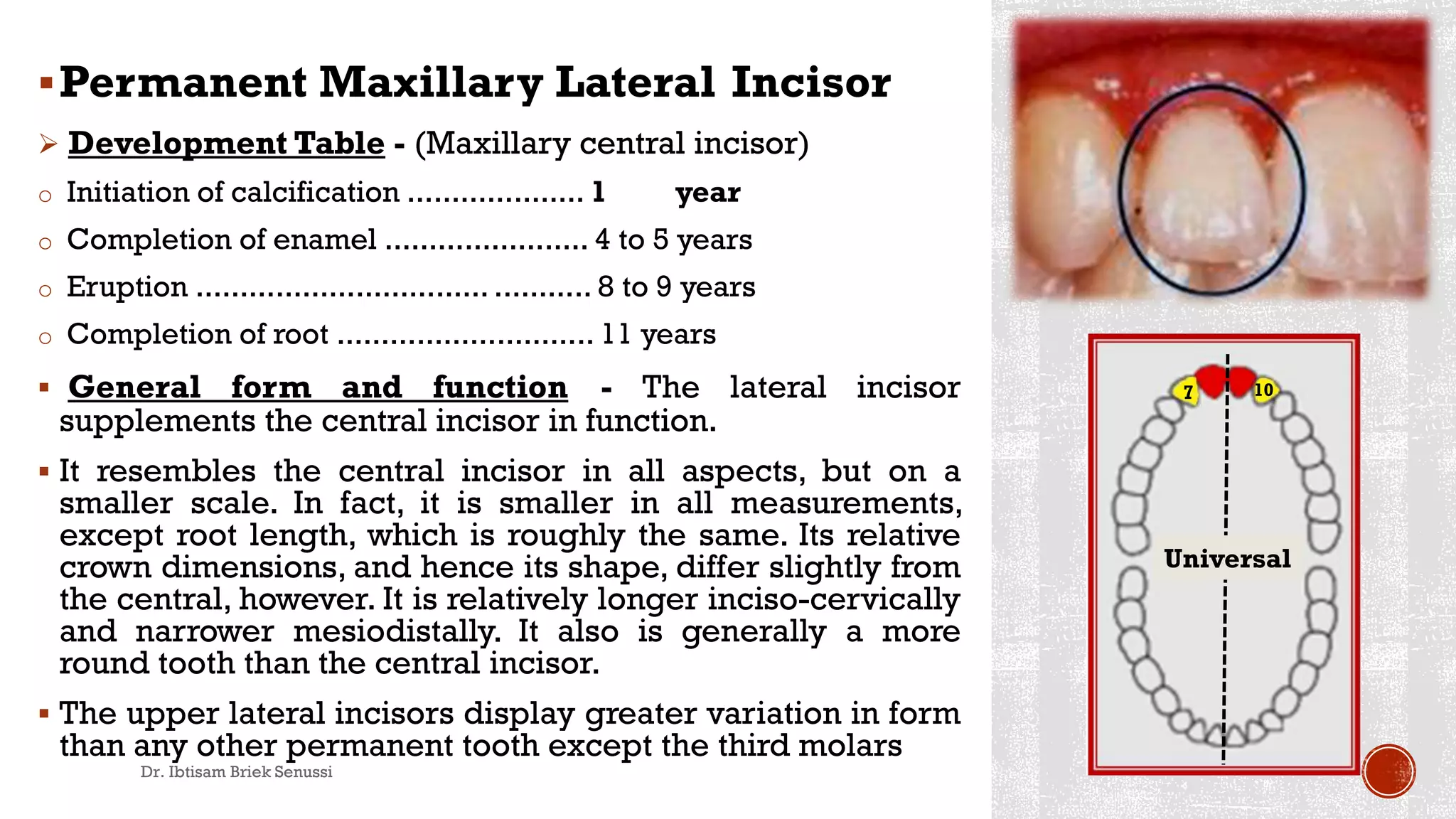 Maxillary lateral incisor. | PDF