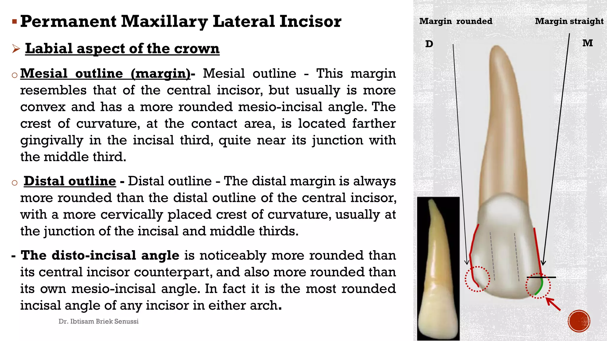 Maxillary lateral incisor. | PDF