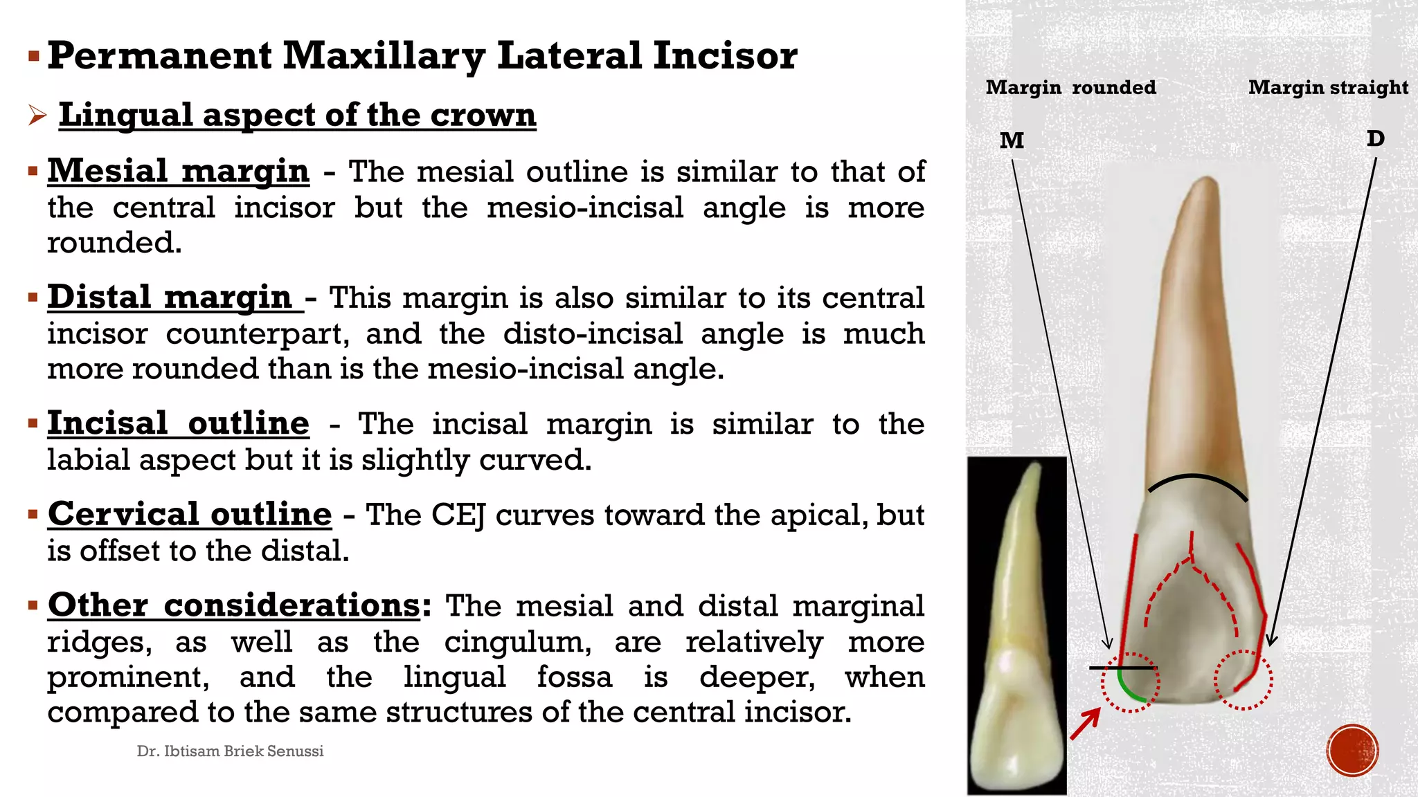 Maxillary lateral incisor. | PDF