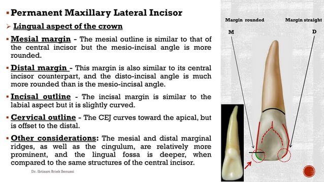 Maxillary lateral incisor. | PDF | Dental Health | Diseases and Conditions