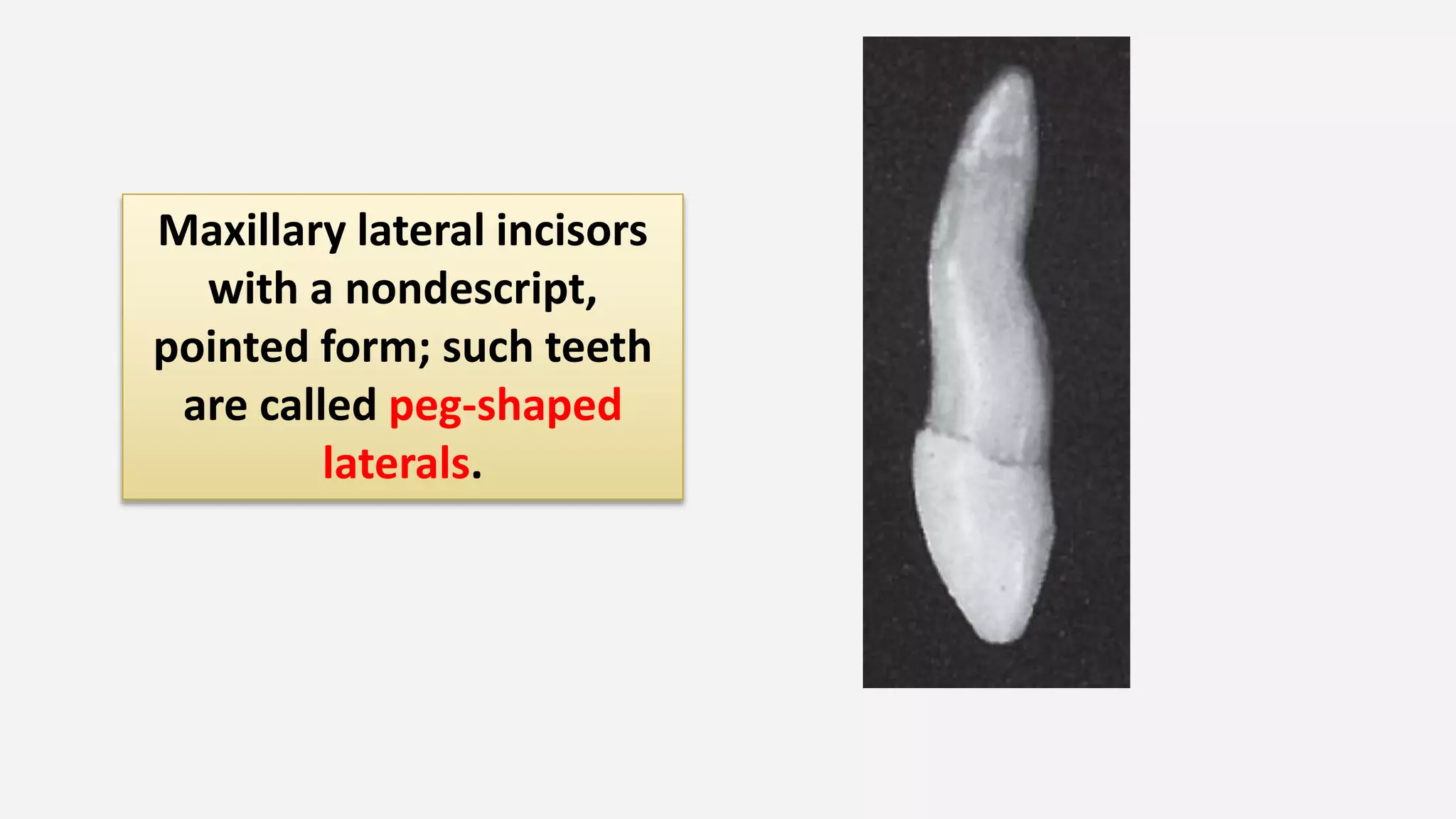 Permanent Maxillary Lateral Incisors-Dr Saba Arshad | PPTX