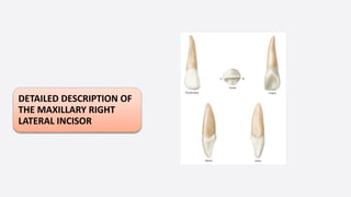 Permanent Maxillary Lateral Incisors-Dr Saba Arshad | PPTX