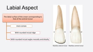 Permanent Maxillary Lateral Incisors-Dr Saba Arshad | PPTX