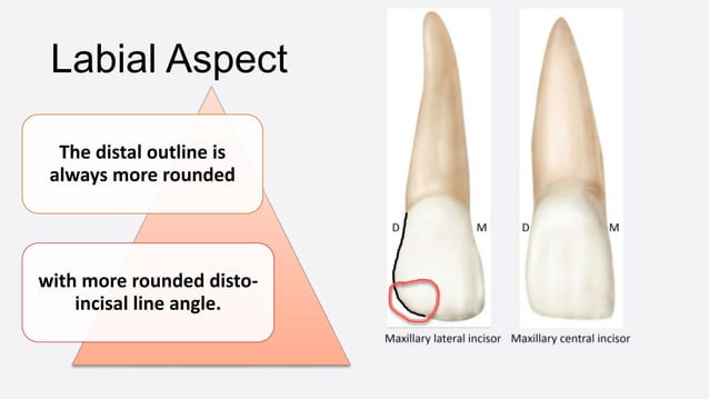 Permanent Maxillary Lateral Incisors-Dr Saba Arshad | PPT