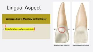 Permanent Maxillary Lateral Incisors-Dr Saba Arshad | PPTX