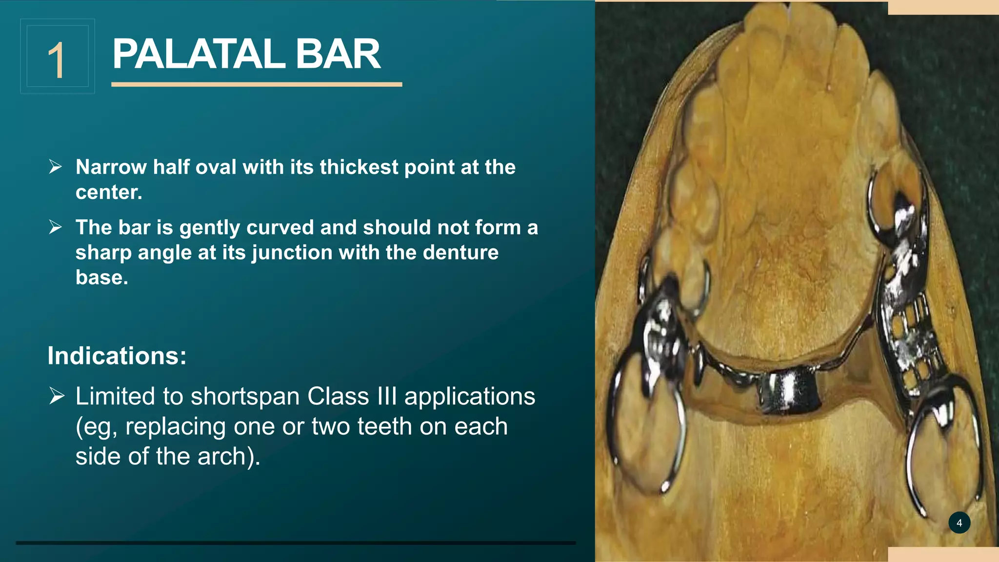Maxillary major connectors by mohammed hekma | PPTX