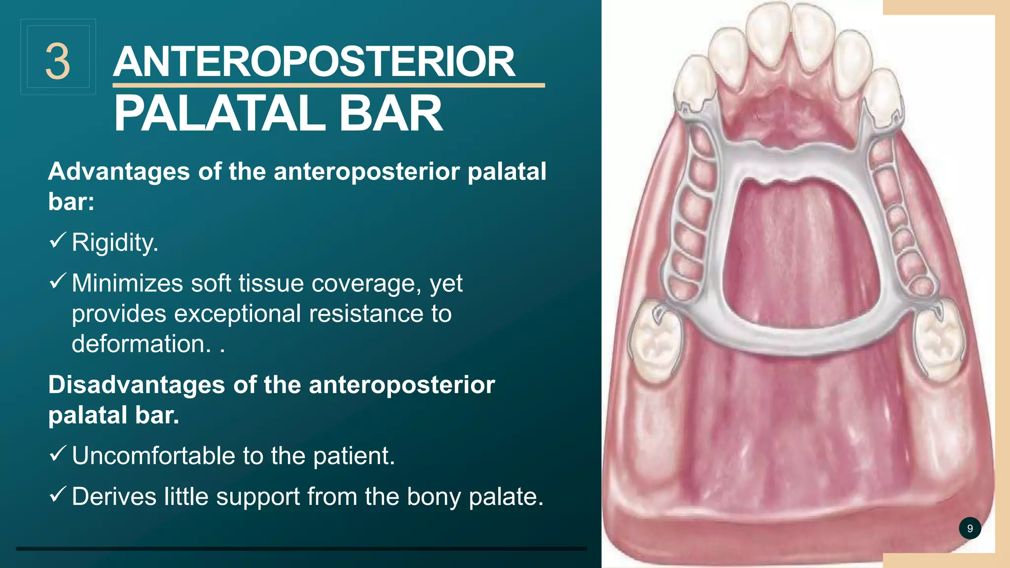 Maxillary major connectors by mohammed hekma | PPTX