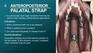 Maxillary major connectors by mohammed hekma | PPTX