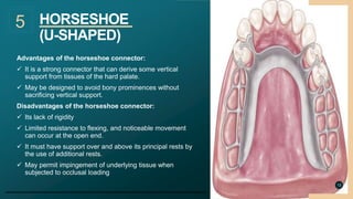 Maxillary major connectors by mohammed hekma | PPTX