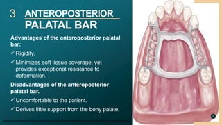 Maxillary major connectors by mohammed hekma | PPTX