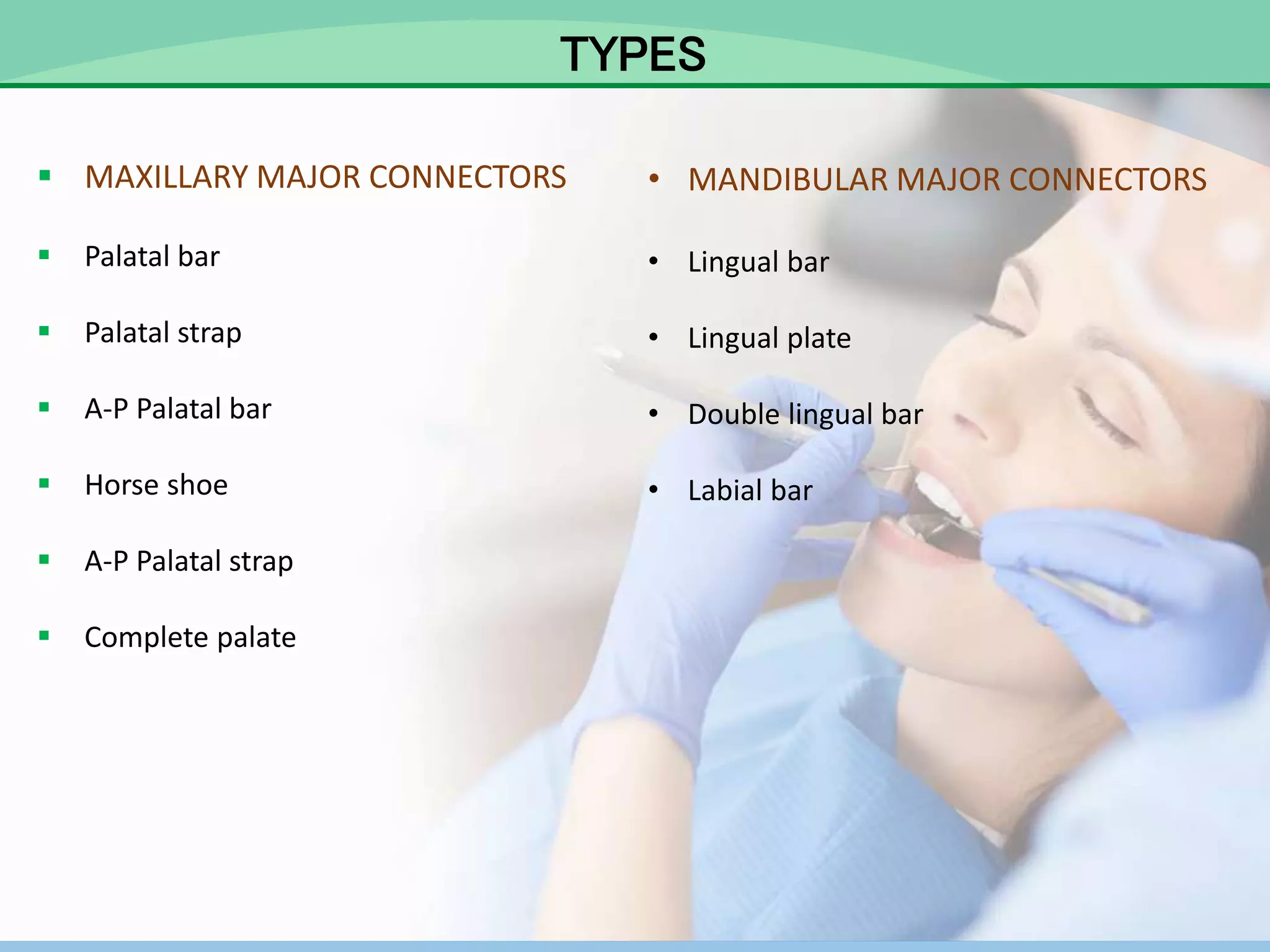 MAXILLARY MAJOR CONNECTOR.pptx