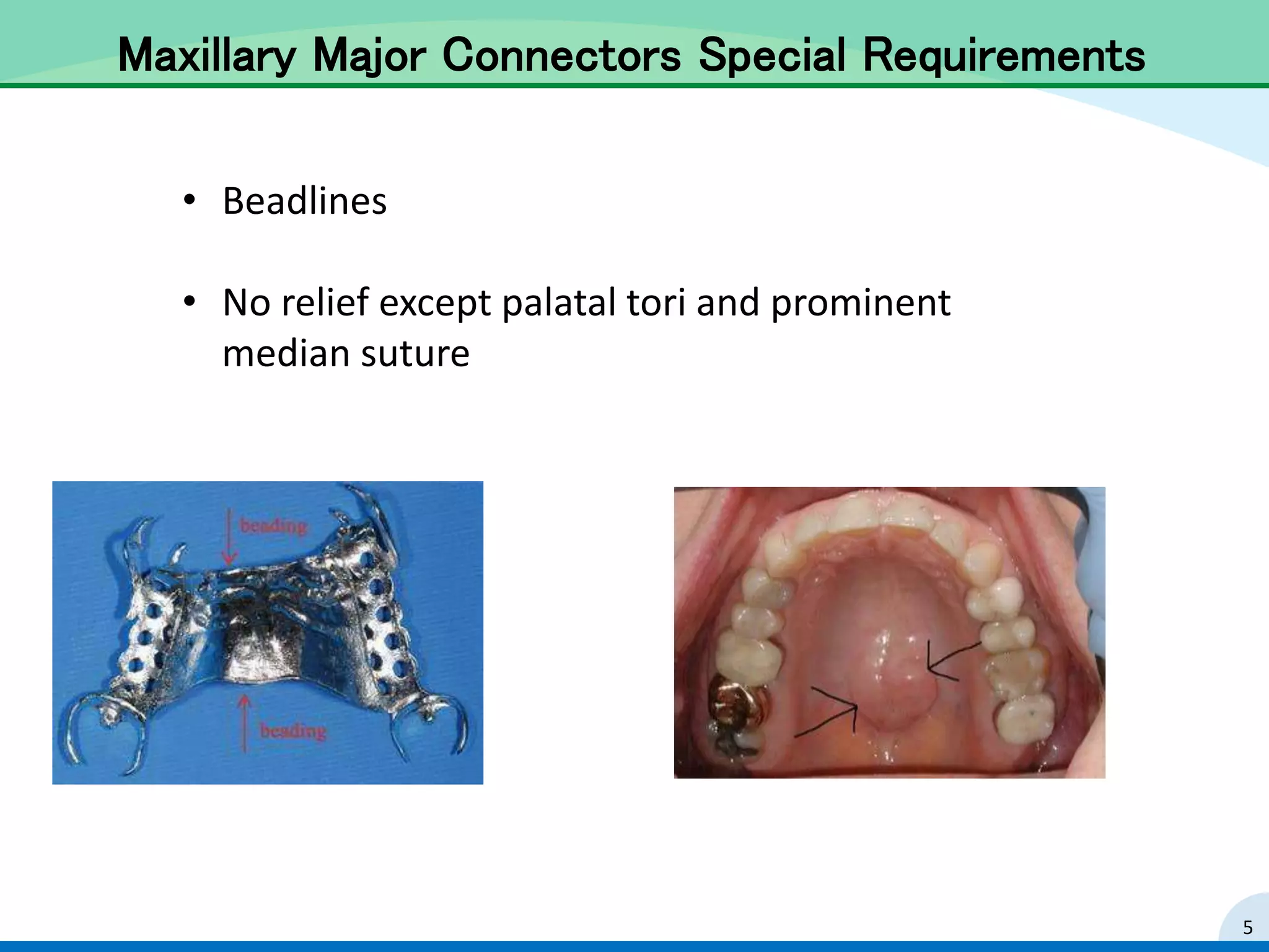 MAXILLARY MAJOR CONNECTOR.pptx