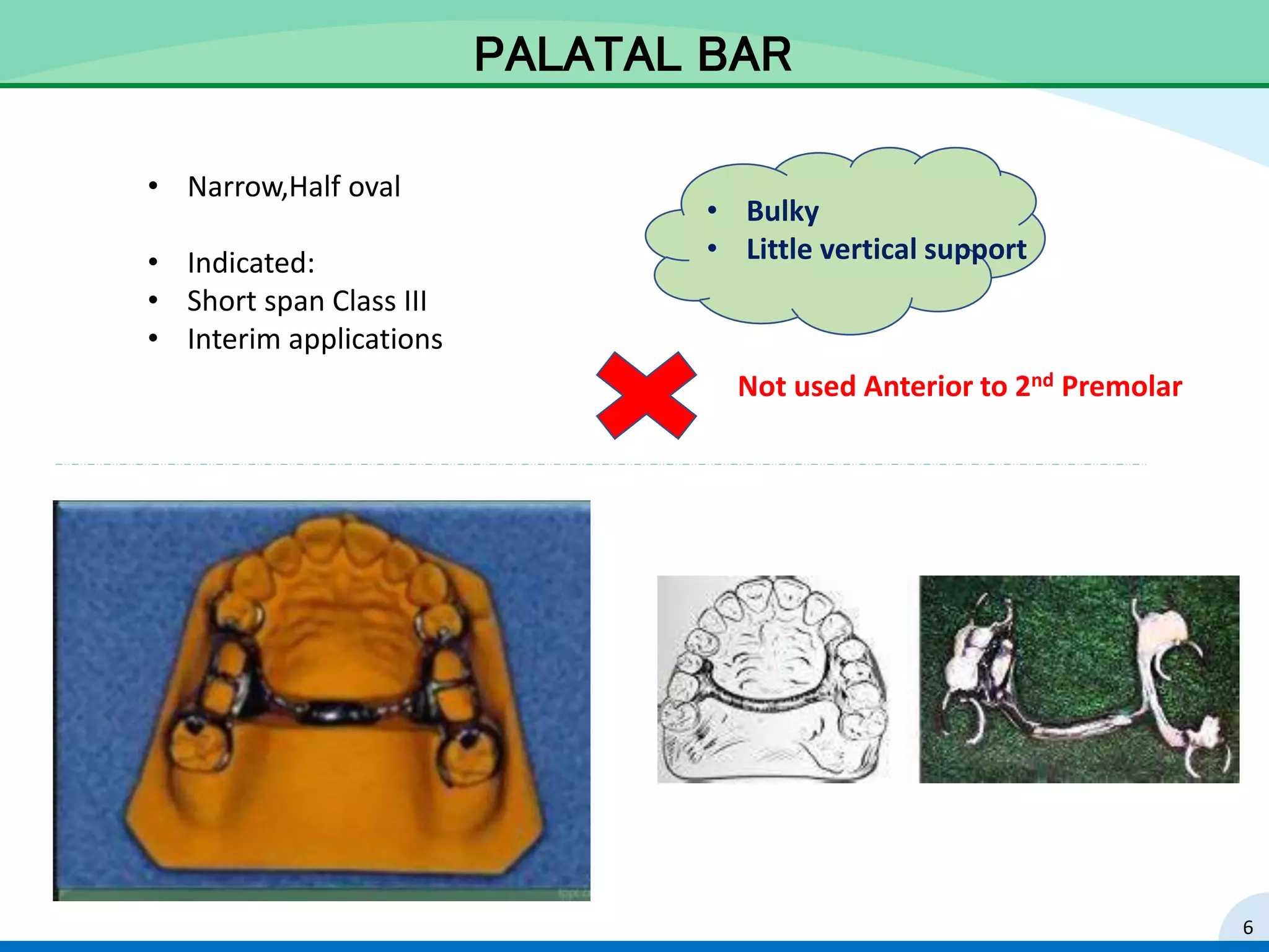 MAXILLARY MAJOR CONNECTOR.pptx