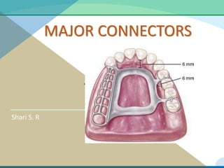 MAXILLARY MAJOR CONNECTOR.pptx
