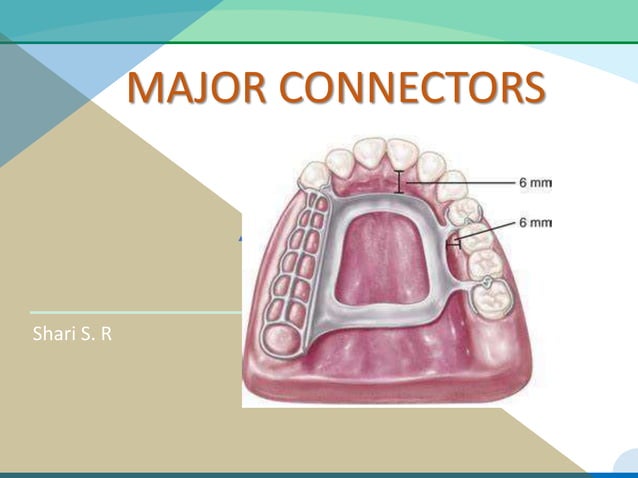 MAXILLARY MAJOR CONNECTOR.pptx | Dental Health | Diseases and Conditions